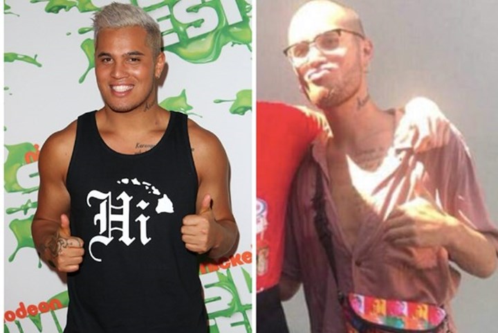 Stan Walker's drastic weight loss due to rare gene mutation | WHO