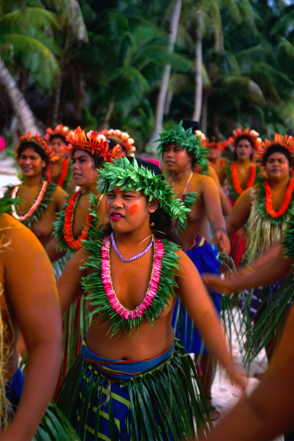 Fattest Country in The World: What is the Most Obese Country? | WHO