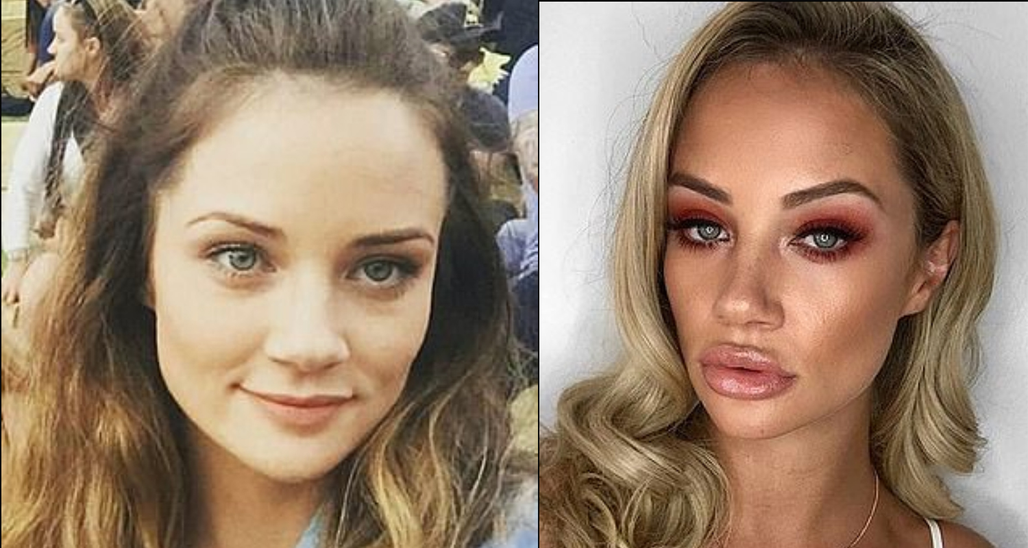 Married at First Sight's Jessika Power shares EXTREME cosmetic work | WHO