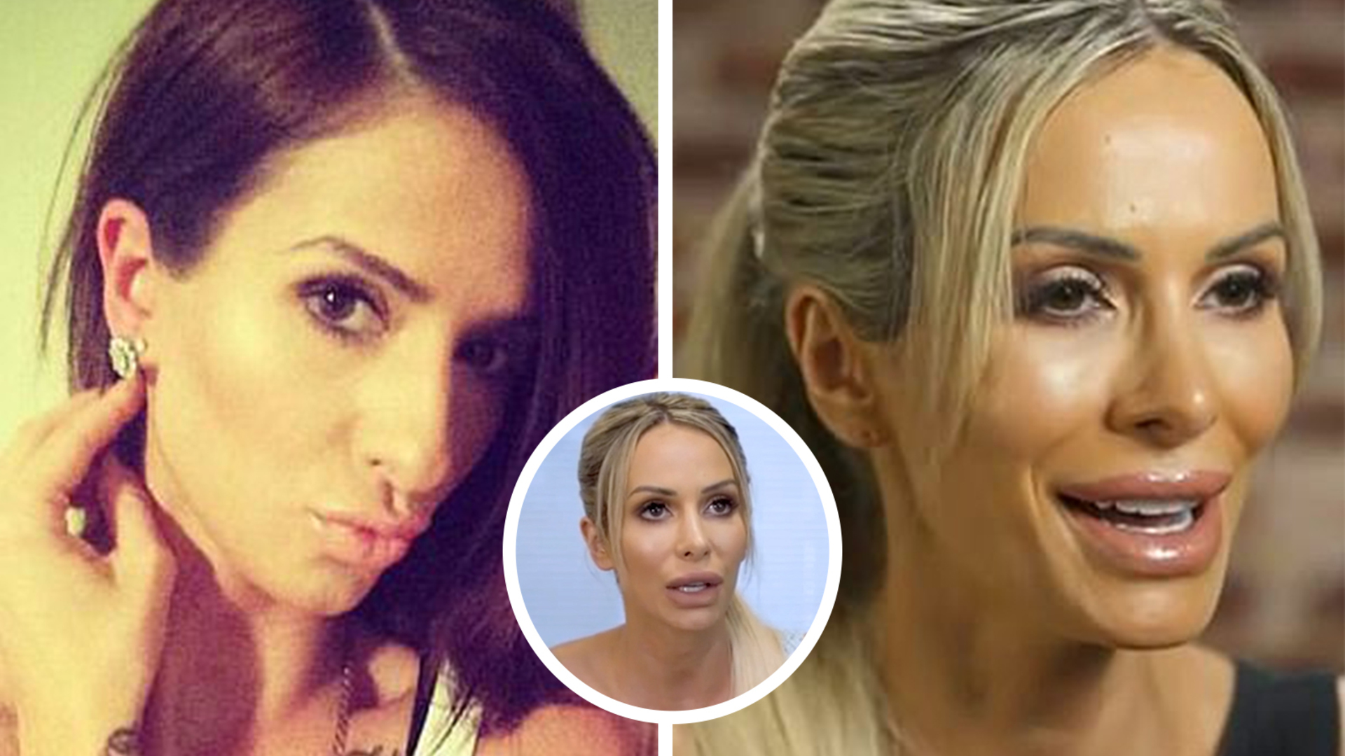 MAFS' Stacey reveals all the cosmetic surgeries she's undergone - WHO