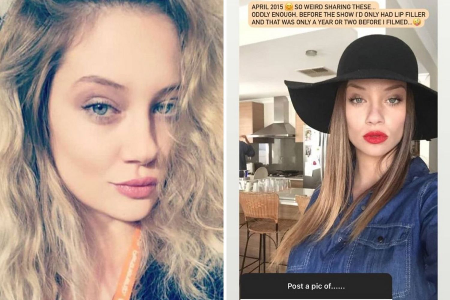 MAFS' Jessika Power's plastic surgery transformation | WHO