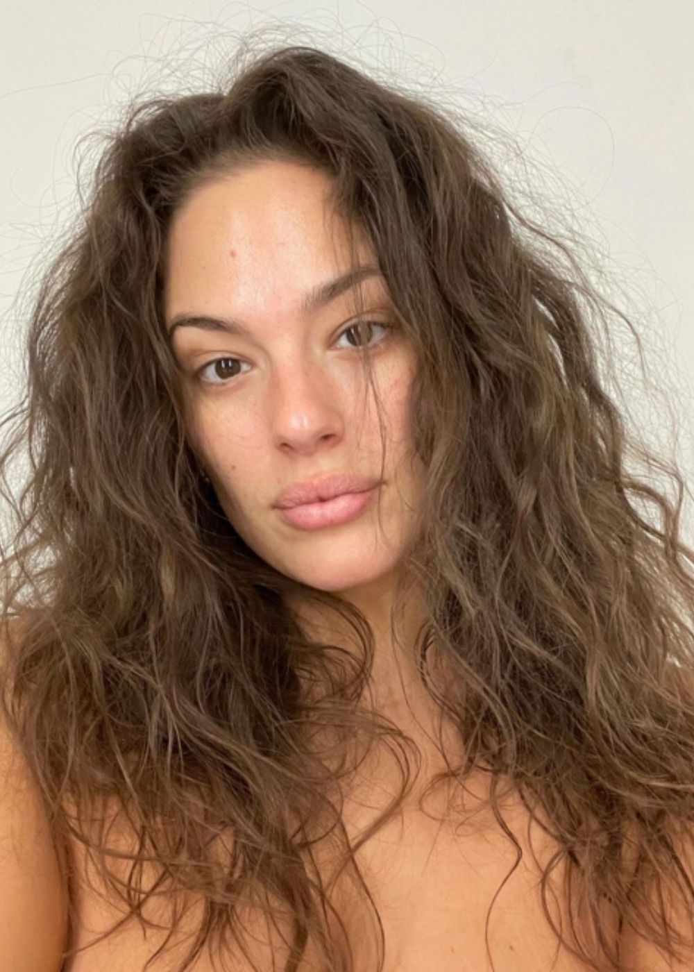 The ultimate summer skincare guide | WHO
